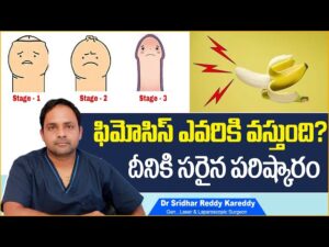 Tips for a Speedy Recovery After Circumcision Treatment